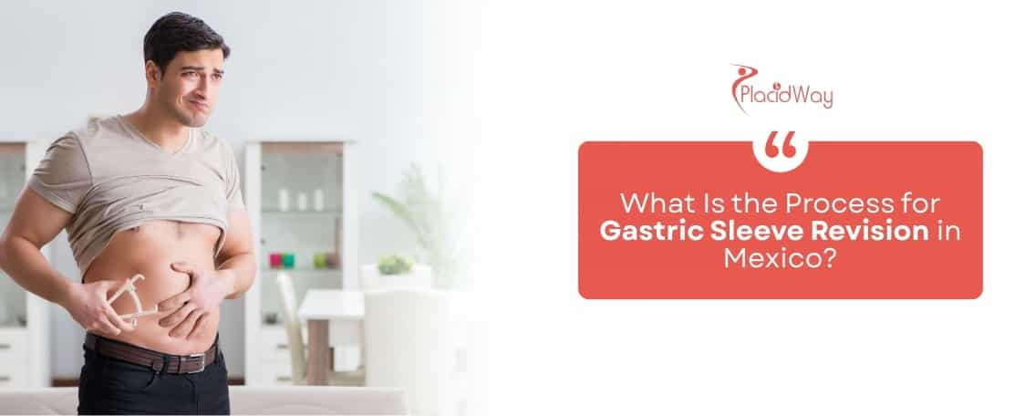 Gastric Sleeve Revision in Mexico | Process, Cost & Recovery