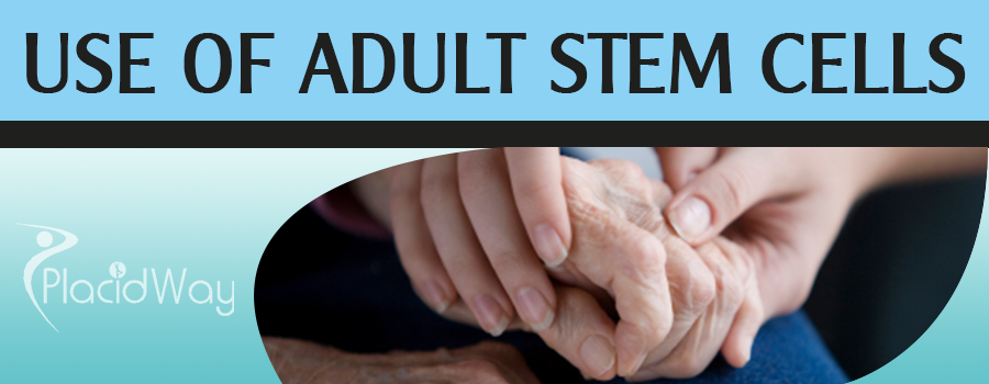 Adult Stem Cell Therapy Treatment Abroad