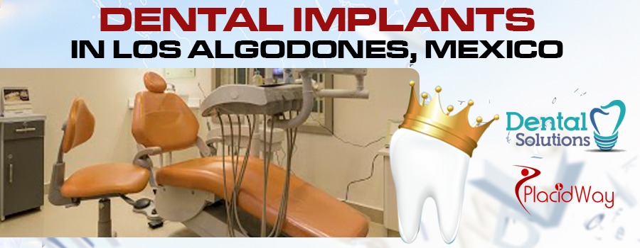 Dental Solutions | All on 4 | Dentistry Clinic Los Algodones, Mexico