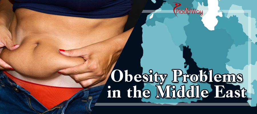 Obesity Surgery Abroad Animation l Weight Loss Surgery