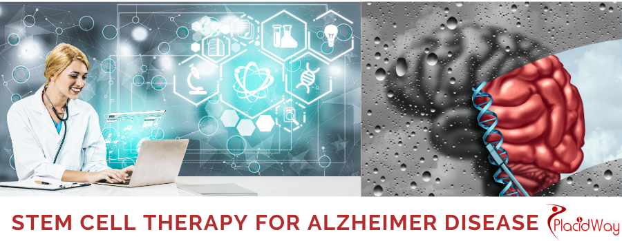 Top 5 Places for Stem Cell Therapy for Alzheimer's Disease
