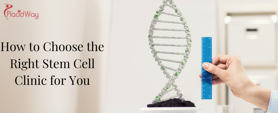 The Ultimate Guide to Choosing the Right Stem Cell Clinic